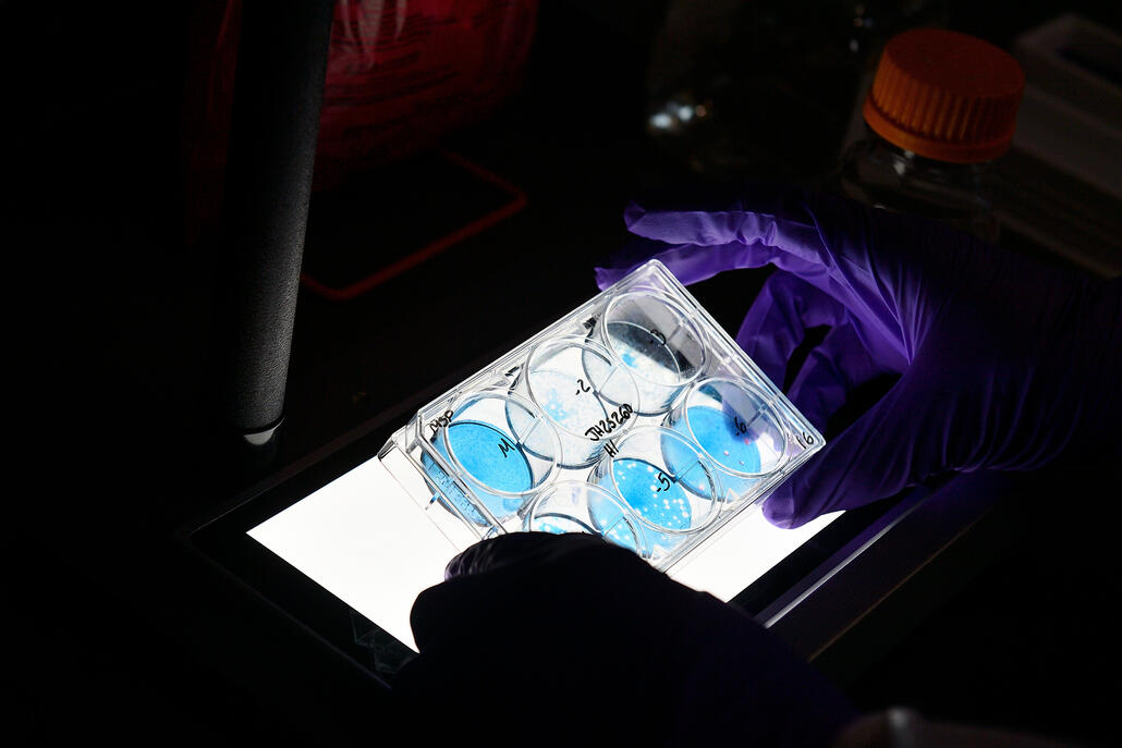 Research Saves Lives: JHU Center of Excellence Leads Global Fight ...